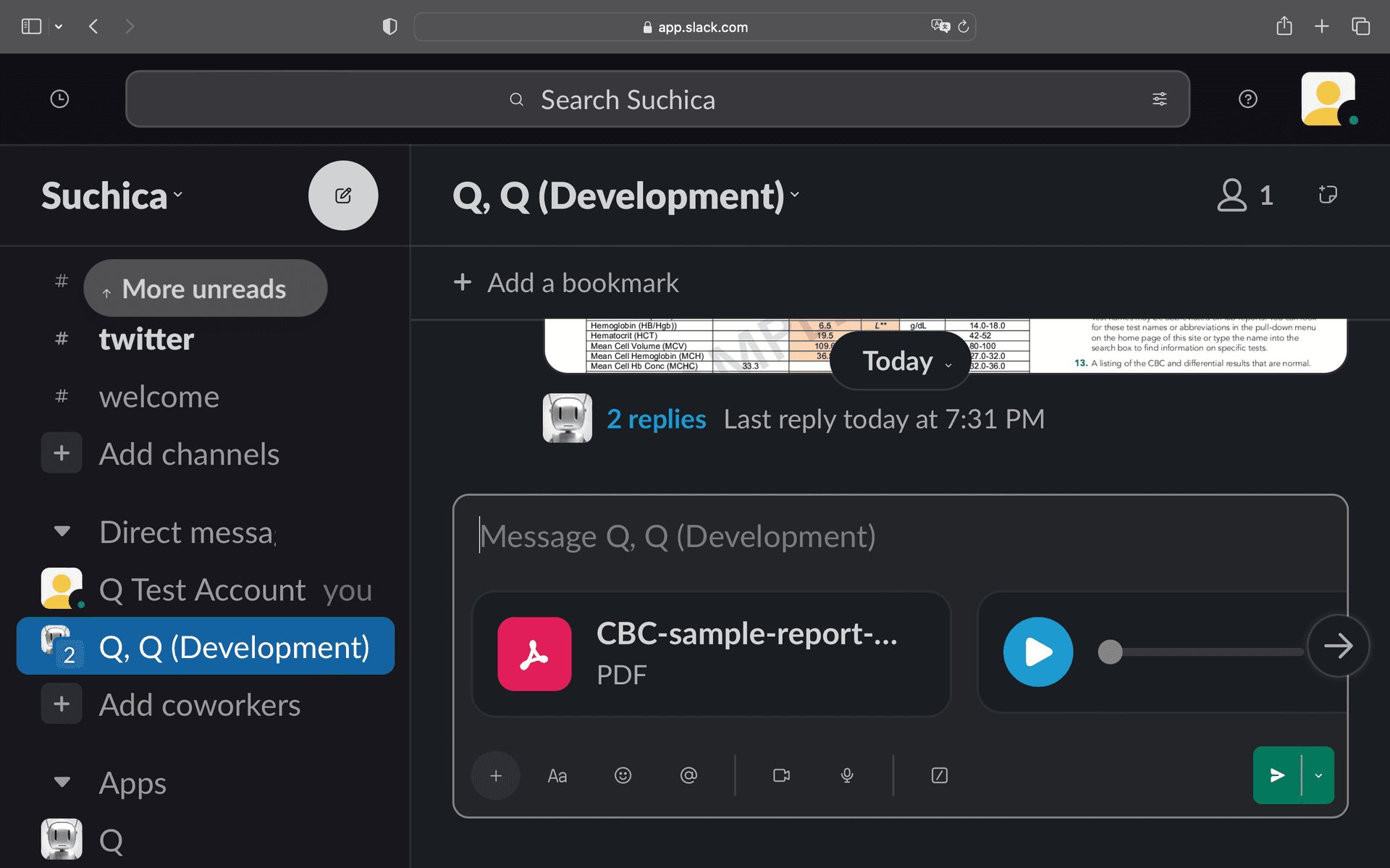Features - Q, ChatGPT for Slack